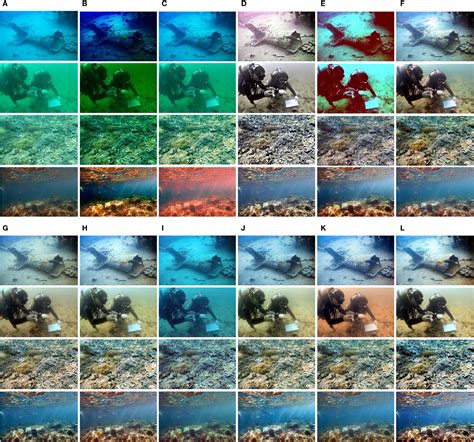 Frontiers A Learnable Full Frequency Transformer Dual Generative Adversarial Network For