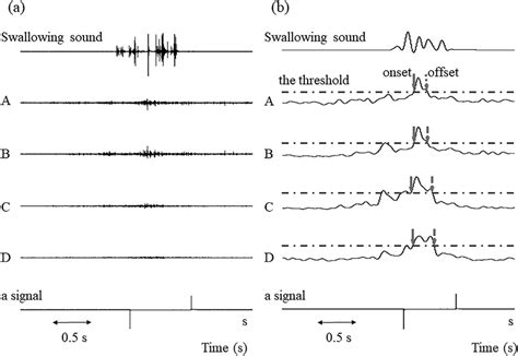 Examples Of Waveforms Before And After Preprocessing At Each Electrode
