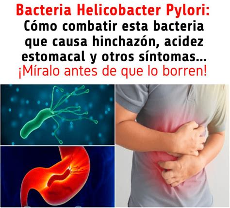 Helicobacter Pylori Antigen Que Es At Patsy Morris Blog