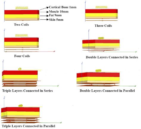 structure of wpt for different methods such as multi layers of coils on