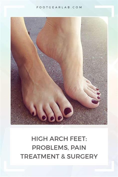 16 Home Remedies For Swollen Feet Symptoms And Treatments Artofit