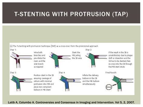 Ppt Bifurcation Stenting A Primer Powerpoint Presentation Id 7078253