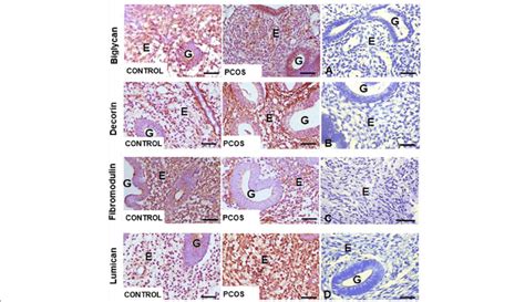 Uterus Proliferative Phase Of Microscopy The Endometrial