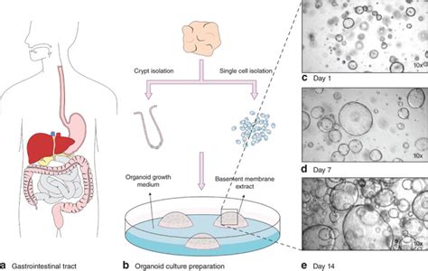Patient Derived Organoid Models Help Define Personalized Management Of