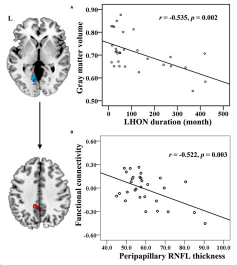 Correlation Between The Neuroimaging Findings And Clinical Measures Download Scientific