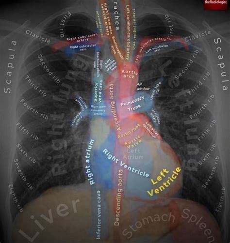 Chest Anatomy Overlay For Emergency Settings Zain Khalpey Md Phd Facs Posted On The Topic