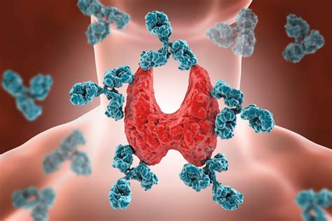 Enfermedades De La Tiroides ¿cómo Detectarlas A Tiempo Salud180