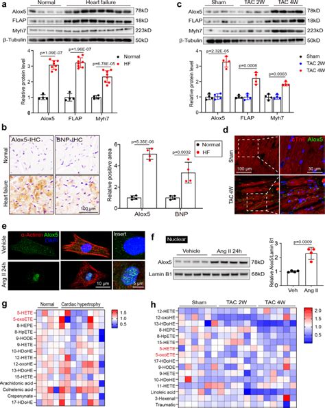 diminished arachidonate 5 lipoxygenase perturbs phase separation and