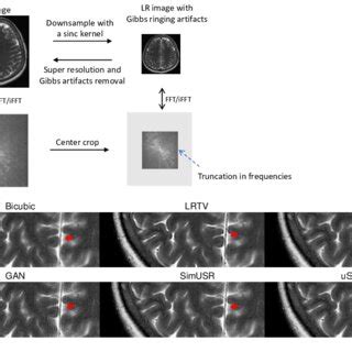 Pdf An Unsupervised Framework For Joint Mri Super Resolution And Gibbs Artifact Removal