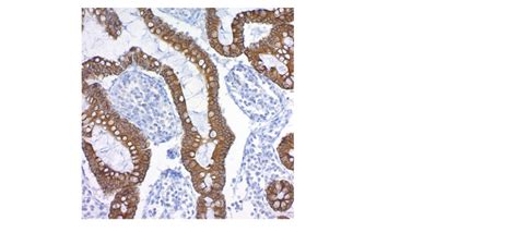 Citrate Buffer10x Ph 60 For Antigen Retriever Gendepot