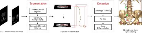 Frontiers A Method For Detecting Ureteral Stent Encrustations In Medical Ct Images Based On