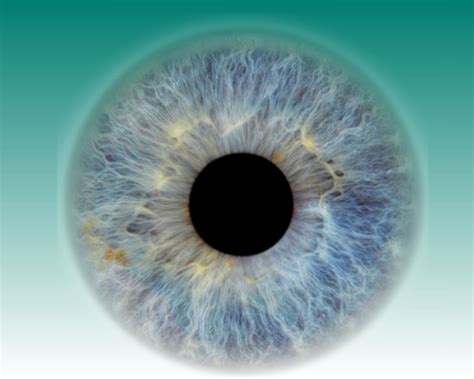 Eye Tumor Causes Symptoms And Treatment In Turkey Soraca Med