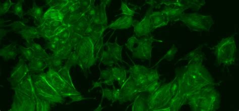 Motic Flexscan1 Fluorescence Slide Scanner Meyer Instruments