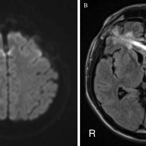 Multidetector Cta Head And Neck Protocols Download Table