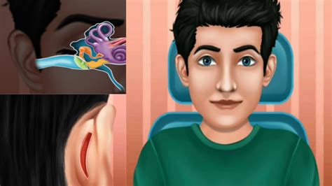 Ear Drops For Fluid Behind Ear Drum At Christie Llamas Blog