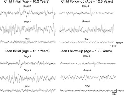 Trait Like Characteristics Of The Sleep EEG Across Adolescent Development Journal Of Neuroscience