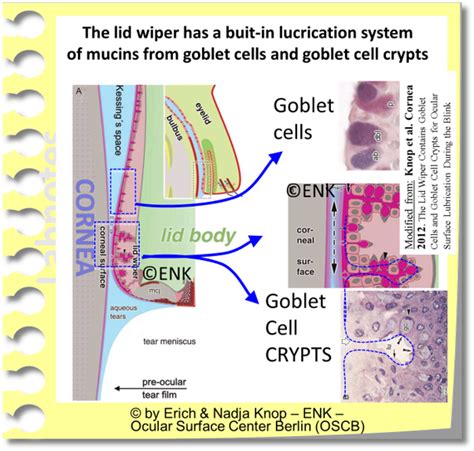 Overview On The Lid Margin — Ocular Surface Center Berlin