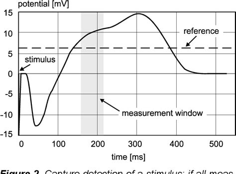 figure 2 from clinical evaluation of a new ddd pacemaker with automatic