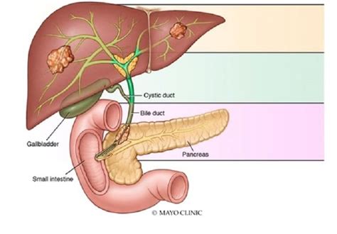 Scientific And Clinical Advances Aid In Diagnosis Staging And Treatment Of Cholangiocarcinoma