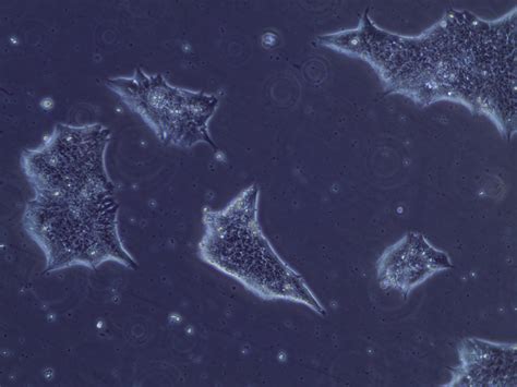 Have My Ipscs Differentiated Researchgate