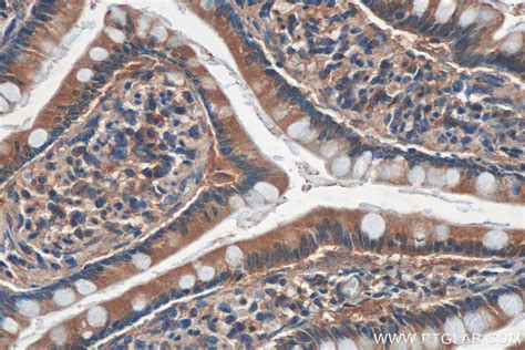 Lpcat3 Antibody 67882 1 Ig Proteintech