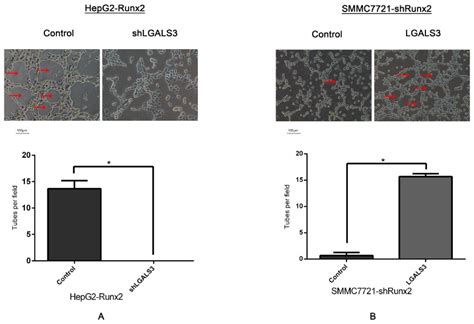 The Expression And Functional Significance Of Runx2 In Hepatocellular