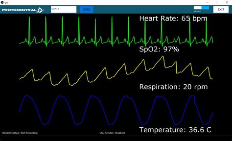 Healthypi 5 Wifi And Ble Biosignal Acquisition Sensor Platform Captures Body Temperature Ecg Ppg