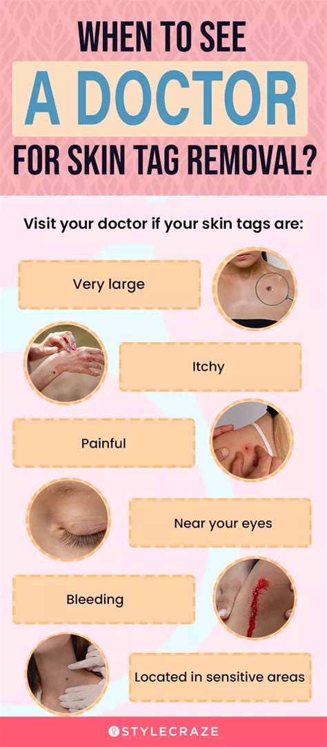 How To Use Apple Cider Vinegar For Skin Tag Removal