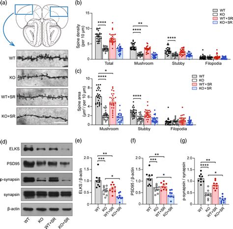 The Development Of Dendritic Spines And Synapses Of Four Groups Mice