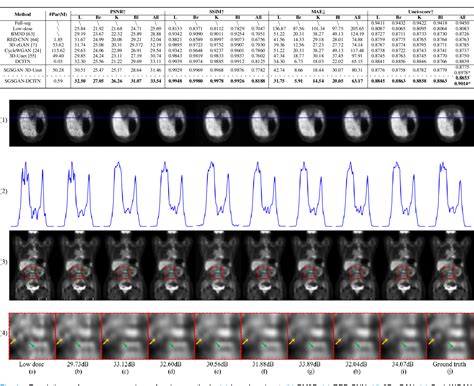 3d segmentation guided style based generative adversarial networks for