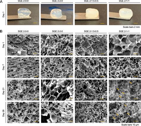 Silk Fibroin Gelatin And Human Placenta Extracellular Matrix Based