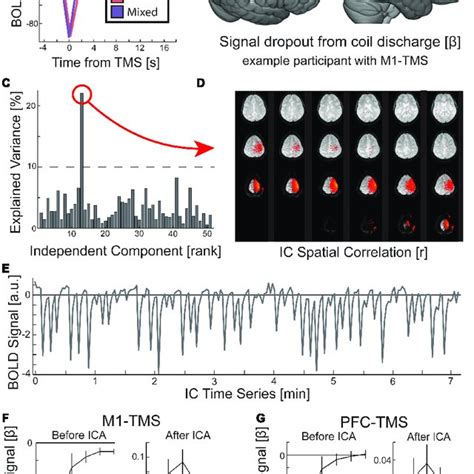 Mri Artifacts That May Arise During Data Acquisition Due To