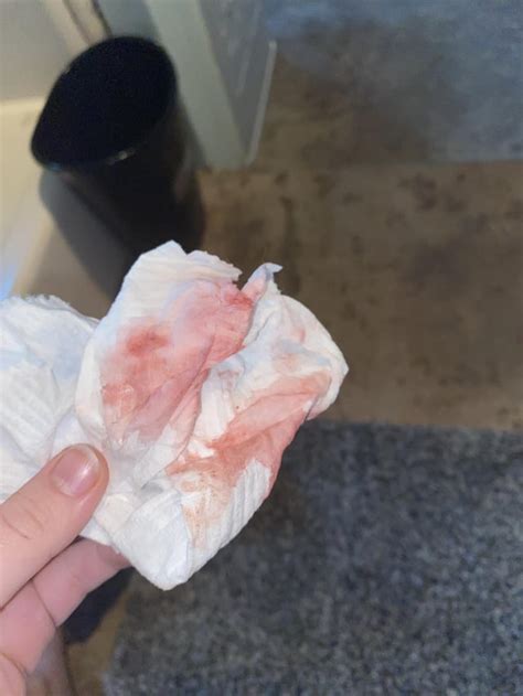 What Does Implantation Bleeding Look Like Pictures