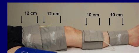 Segmental Pressures Flashcards Quizlet