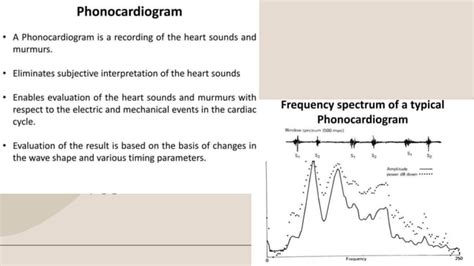 Phonocardiogrampptx Heart And Cardiovascular Diseases Diseases And