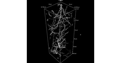 Nikon Introduces All New Spatial Array Confocal Nsparc Detector For Ax