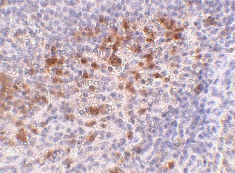 Cathelicidin Polyclonal Antibody Invitrogen 100 μg Unconjugated