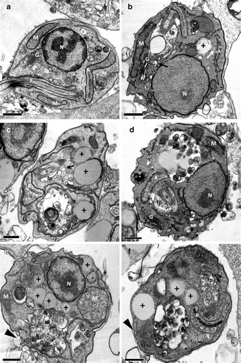 Ultrastructural Analysis Transmission Electron Microscopy Of L Download Scientific Diagram