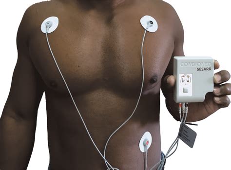 The Ecg Recorder Prototype Download Scientific Diagram