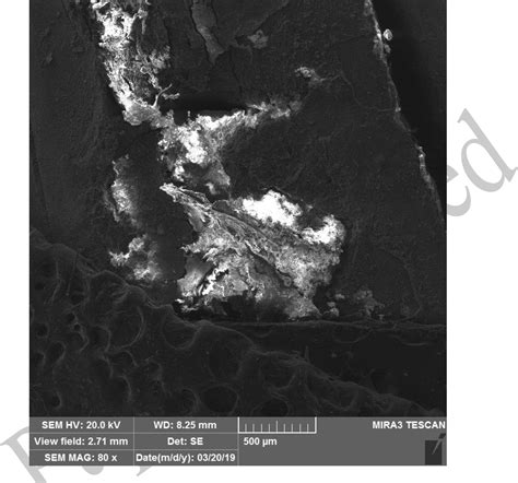 Figure 1 From Efficiency Of Calcium Hydroxide Removal Techniques From Simulated Internal