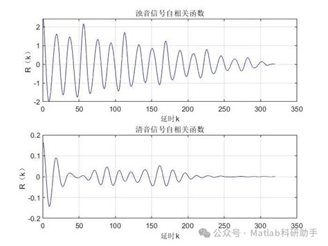 【语音处理】语音信号时域频域分析降噪滤波，端点检测，特征提取附matlab代码语音信号时域特征分析 Csdn博客