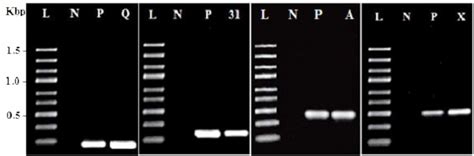 Amplification Results For Screening Enterocin Genes In Enterococcus Download Scientific Diagram