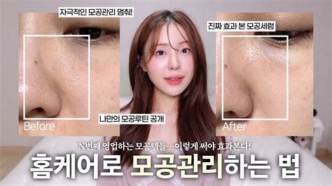 내가 정착한 모공 스킨케어템 ️인생 모공 홈케어 방법 공개🍯 모공템 추천 모공 세럼 추천 토너패드 추천 홈케어 피부관리 하는 법 모델링팩 하는버