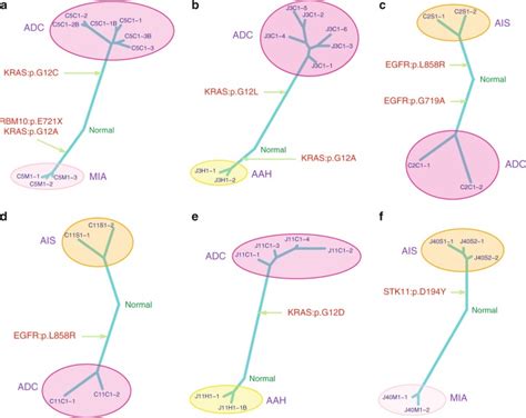 Multi Region Exome Sequencing Reveals Genomic Evolution From
