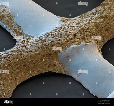 Coloured Scanning Electron Micrograph Sem Of A Bioprinted Bone Construct On Day 6 Of