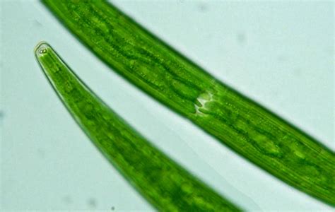 Protist Images Closterium Intermedium