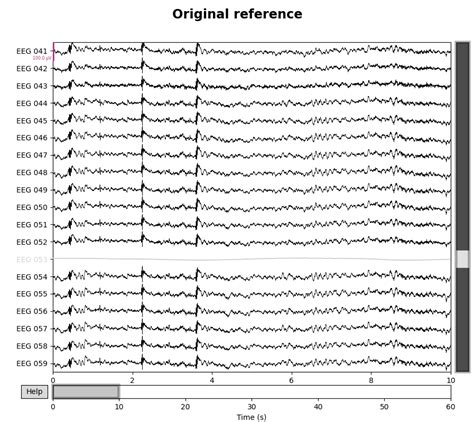 Setting The Eeg Reference — Mne 122 Documentation