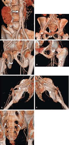 Postprocessing And Data Analysis Thoracic Key