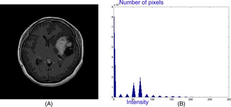 Fuzzy Histogram Equalization And Contrast Enhanced Image A And