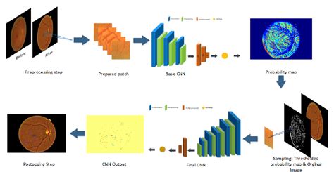 Figure 2 From Microaneurysm Detection In Fundus Images Using A Two Step